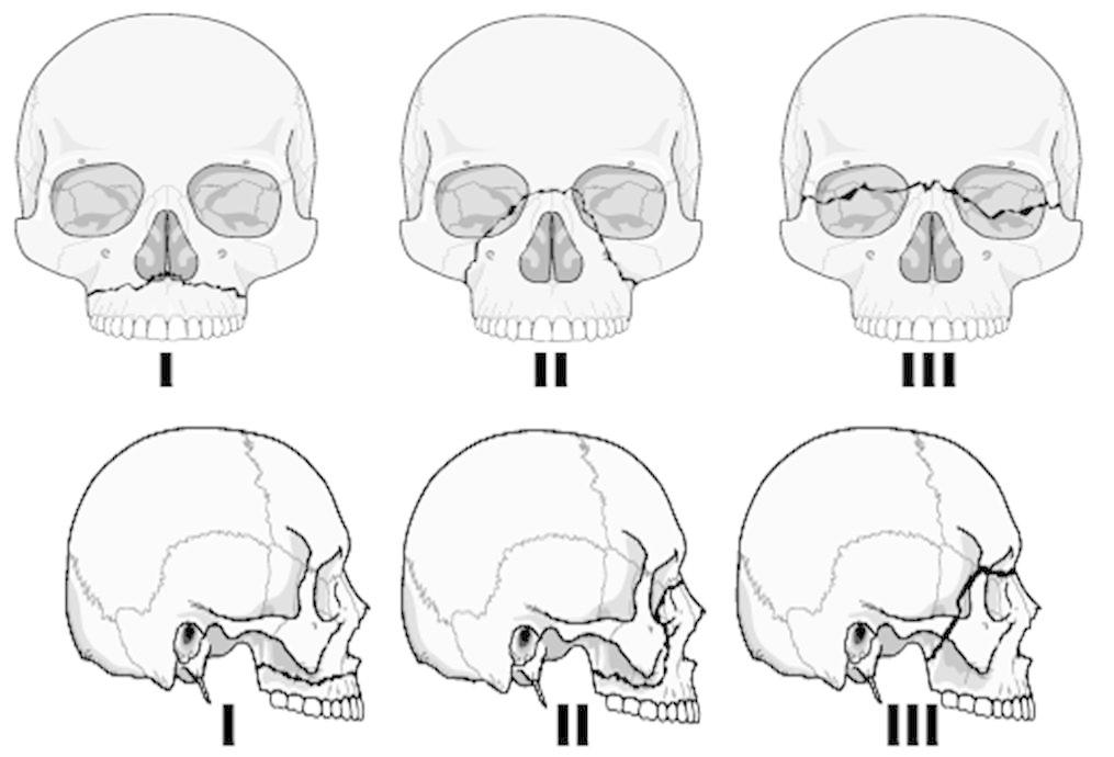 Image Based Question-58507 - www.medicoapps.org